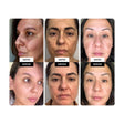 VISAGE D'OR — Sérum Clareador de Manchas & Melasma